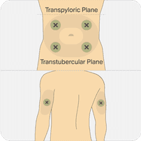 Depot Delivery & Administration | PERSERIS® (risperidone) HCP